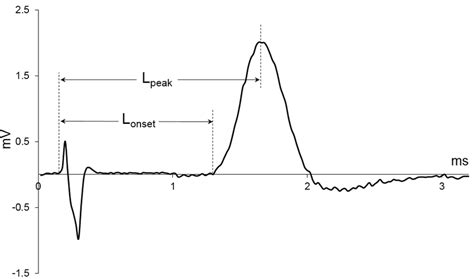 Two Different Latency Measurements L Onset And L Peak Shown On A