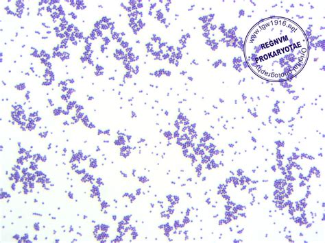 Regnum Prokaryotae Microscope Images