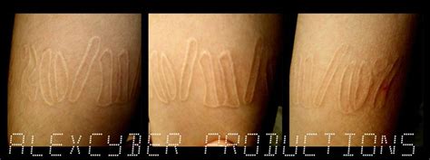 Scarification By AlexCyber BodyArt On DeviantArt