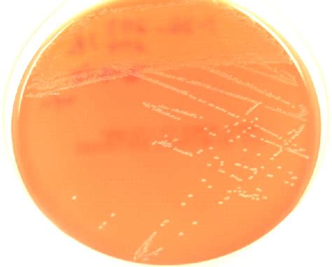 Table 1 From A Case Report Of Arcanobacterium Haemolyticum Isolated From Diabetic Patient With