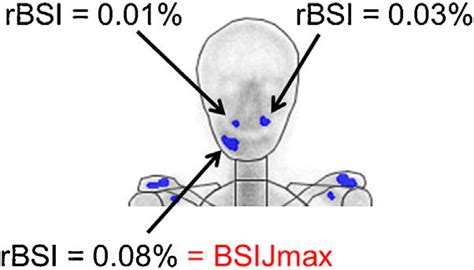 Example Of A Bone Scintigraphy Image Analyzed By The Artificial