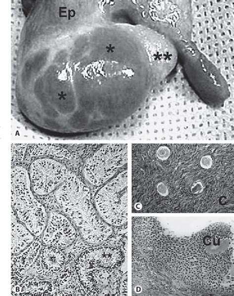 Hermaphroditism