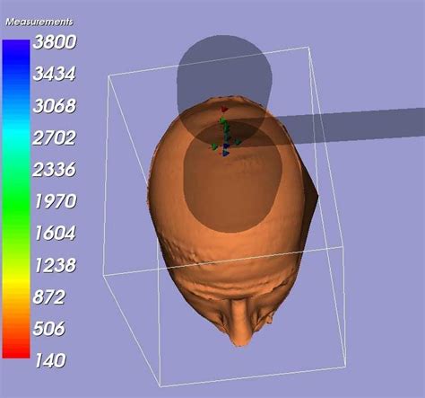Motor Cortex Mapping Results Based On Laser Scans Download Scientific Diagram
