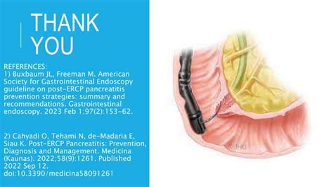 Post Ercp Pancreatitis Risk Factors Prevention Treatment Pptx