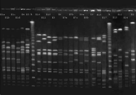 Pfge Patterns Of Representative Predominant Mrsa Clones Identified From