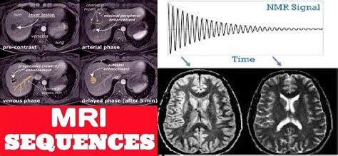 What Is The Difference Between Mri Sequences And Mri Series Blogs