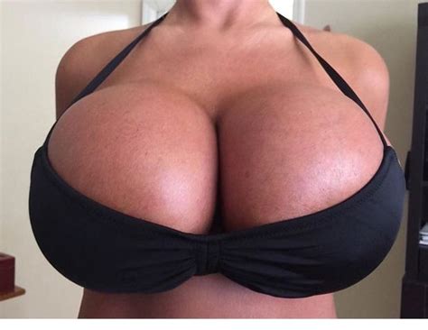 Foto De We Love Huge Fake Breast Implants