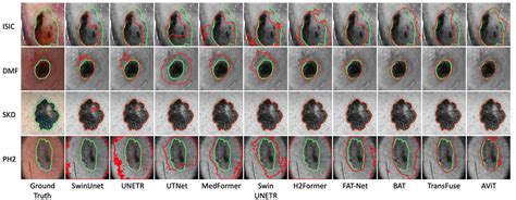 Visual Comparison With Different Sota Methods The Green Contours Are