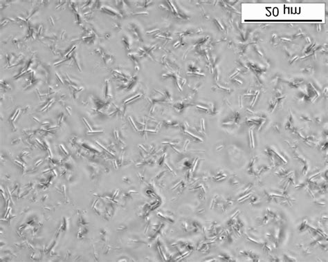 Needle Like Fibrils Formed By Hfbi As Observed With A Light Microscope