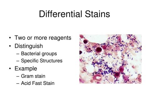 PPT Bacterial Staining PowerPoint Presentation ID 502480