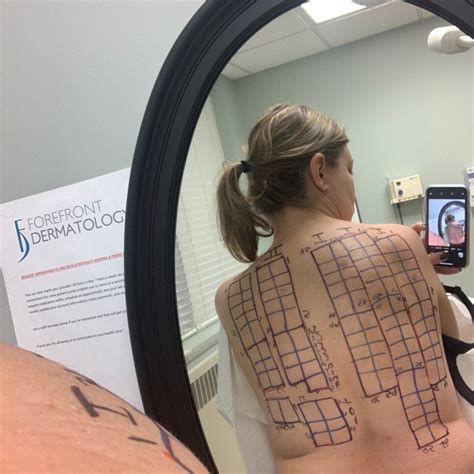 What Is A Patch Test The Allergy Life