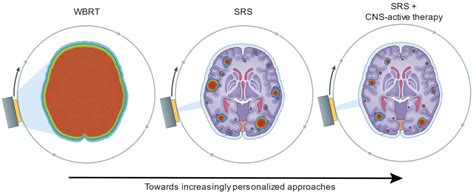 Lung Cancer Brain New Dual Stem Cell Therapy Developed To Treat Brain