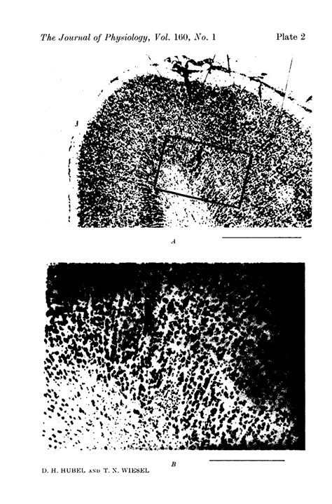 Receptive Fields Binocular Interaction And Functional Architecture In The Cats Visual Cortex Pmc