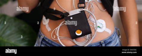 24 hour ecg monitoring and holter monitoring on a woman body cardiac