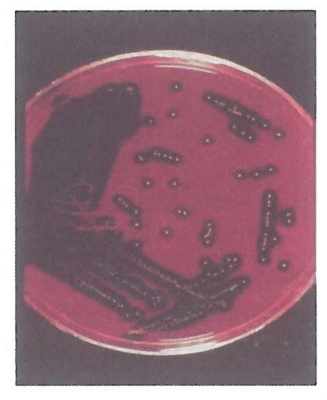 Staphylococcus Aureus Morphology Culture Virulence And Diseases