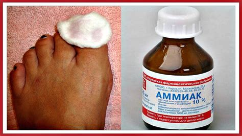 КОПЕЕЧНОЕ аптечное средство ЛЕЧИТ грибок ногтей Youtube