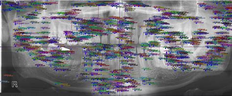 Plotting Result Example · Issue 6 · Serdarhellisegmentation Of Teeth