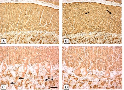 Expression Of Synaptophysin In The Cerebellum Cortex Of Rats A Download Scientific Diagram