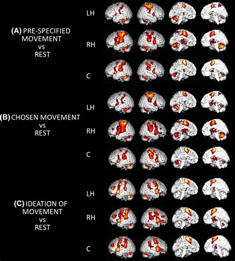 Areas Of Significant Activation For A Pre Specified Movement Execution Download Scientific