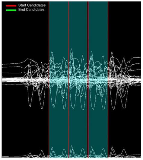 A Time Scalable Posture Detection Algorithm For Paraplegic Patient