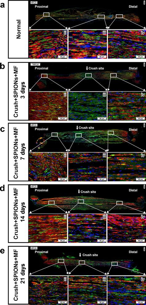 Regeneration And Repair Of The Sciatic Nerve After Crush Injury In The