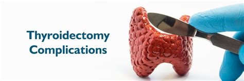 Thyroidectomy Complications Risks Side Effects And Recovery Tips