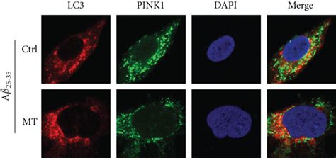 The Ad Cell Model Was Constructed In Sh Sy5y Cells With Aβ25 35