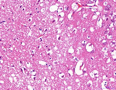 He染色【组织病理染色】 贵州吉创生物技术有限公司[官网] 贵州生物实验公司 贵阳生物实验室 贵阳生物技术实验公司