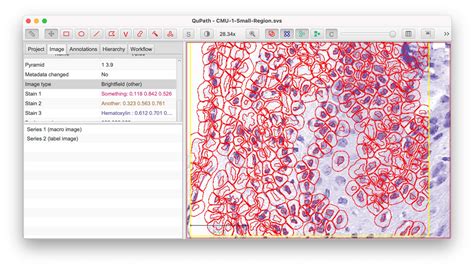 Cell Detection Using Hematoxylin Always Assumes It Is The First Stain · Issue 878 · Qupath