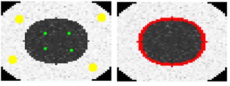 Segmentation Of A Noisy Synthetic 2d Dt Mri Slice Download