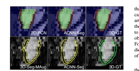 Segmentation Results On Two Different 2D Stack Cardiac MR Images The Download Scientific