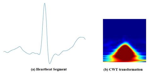 Using Convolutional Neural Network And A Single Heartbeat For Ecg Biometric Recognition