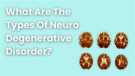 What Are The Types Of Neuro Degenerative Disorder Margadarsi Foundation
