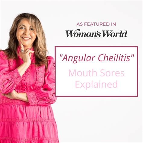 Angular Cheilitis Mouth Sores Explained Mona Dermatology