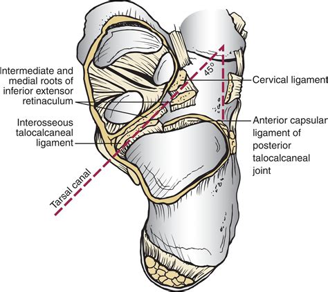 Talus Fractures And Peritalar Dislocations Clinical Tree