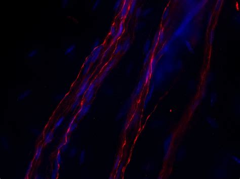 Synaptic Systems Trpv1
