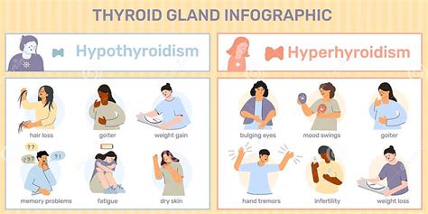 Human Thyroid Gland Infographics Stock Vector Illustration Of Thyroid