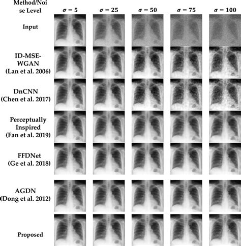 Second Example Results Of The Jsrt Dataset For Blind Image Denoising Download Scientific