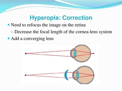 Ppt Human Vision And Vision Correction Phr 177course Powerpoint