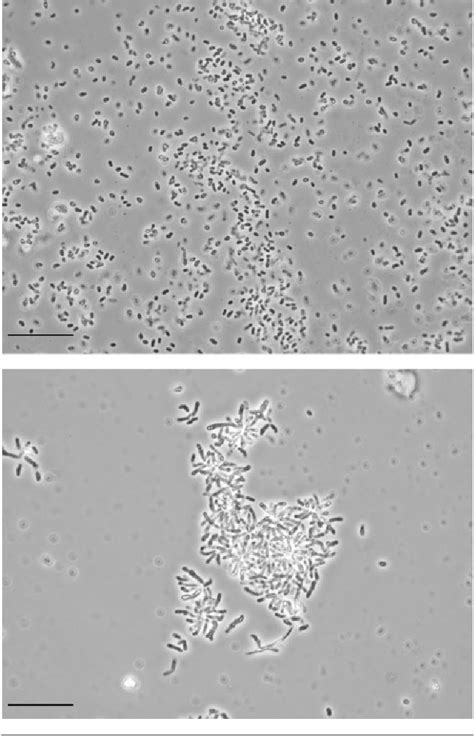 Methylobacterium Radiotolerans Semantic Scholar