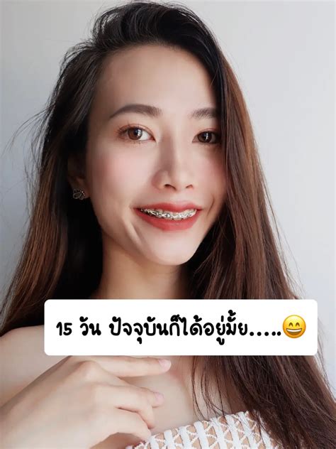 How To ใส่ยางสีขาวจะรอดหรือปังพิจารณาเอาค่า😁🤍🎉💛 แกลเลอรีที่โพสต์โดย