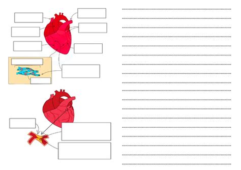 Igcse Biology Edexcel Coronary Heart Disease Teaching Resources