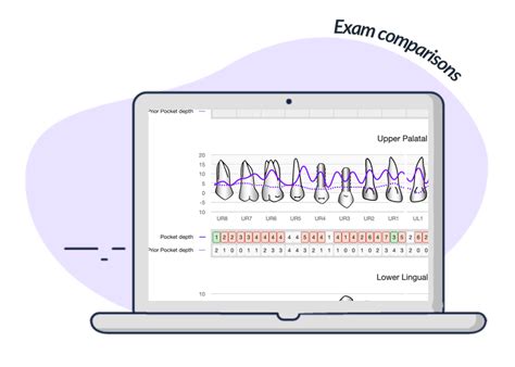 Introducing The New Perio Exam In Dentally