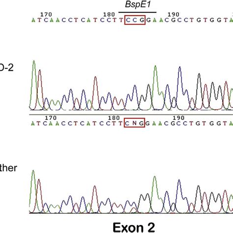 Missense Mutations Identified In Exon 9 C 1978c T And 10 C 2006a G Download Scientific