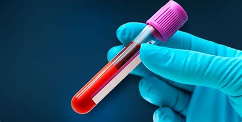 Ama Recognizes Mdw With Pla Code