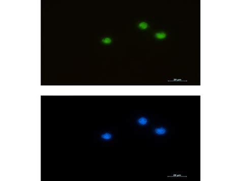 兔抗hdac1单克隆抗体anti Hdac1 Rabbit Monoclonal Antibody 生命科学产品与技术服务 生工生物工程