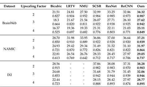 table 1 from gradient guided convolutional neural network for mri image