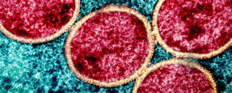 Mpox Disease Expert Explains Why Its Now A Global Health Emergency