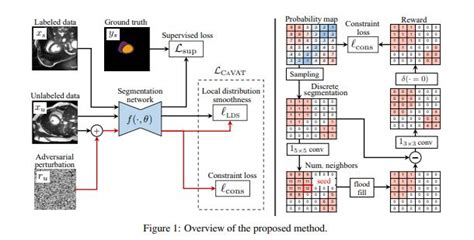 Context Aware Virtual Adversarial Training For Anatomically Plausible Segmentation