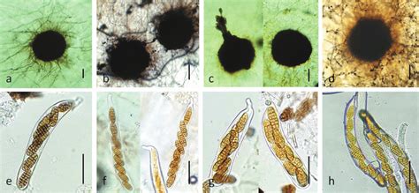 Stemphylium Spp Ascoma Asci And Ascospores Of Teleomorph Stages